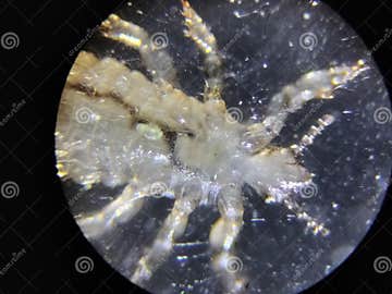 The Head Louse (Pediculus Humanus Capitis) Stock Image - Image of ...