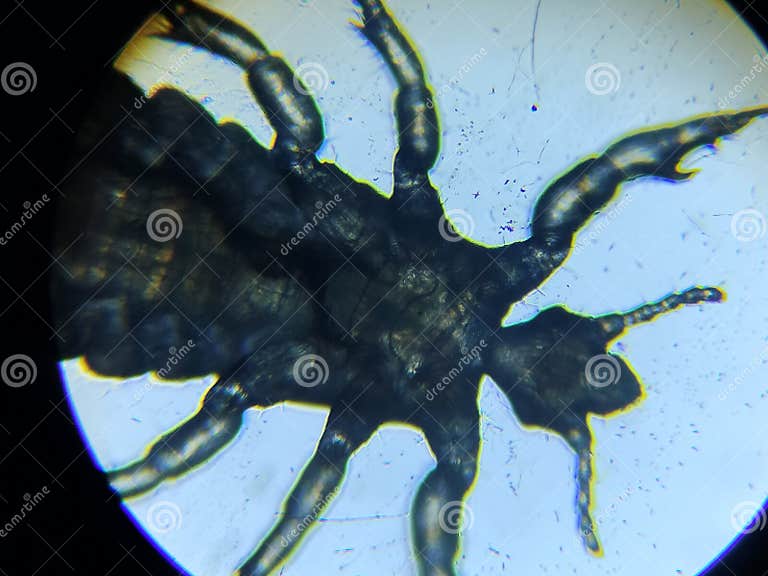 The Head Louse (Pediculus Humanus Capitis) Stock Image - Image of ...