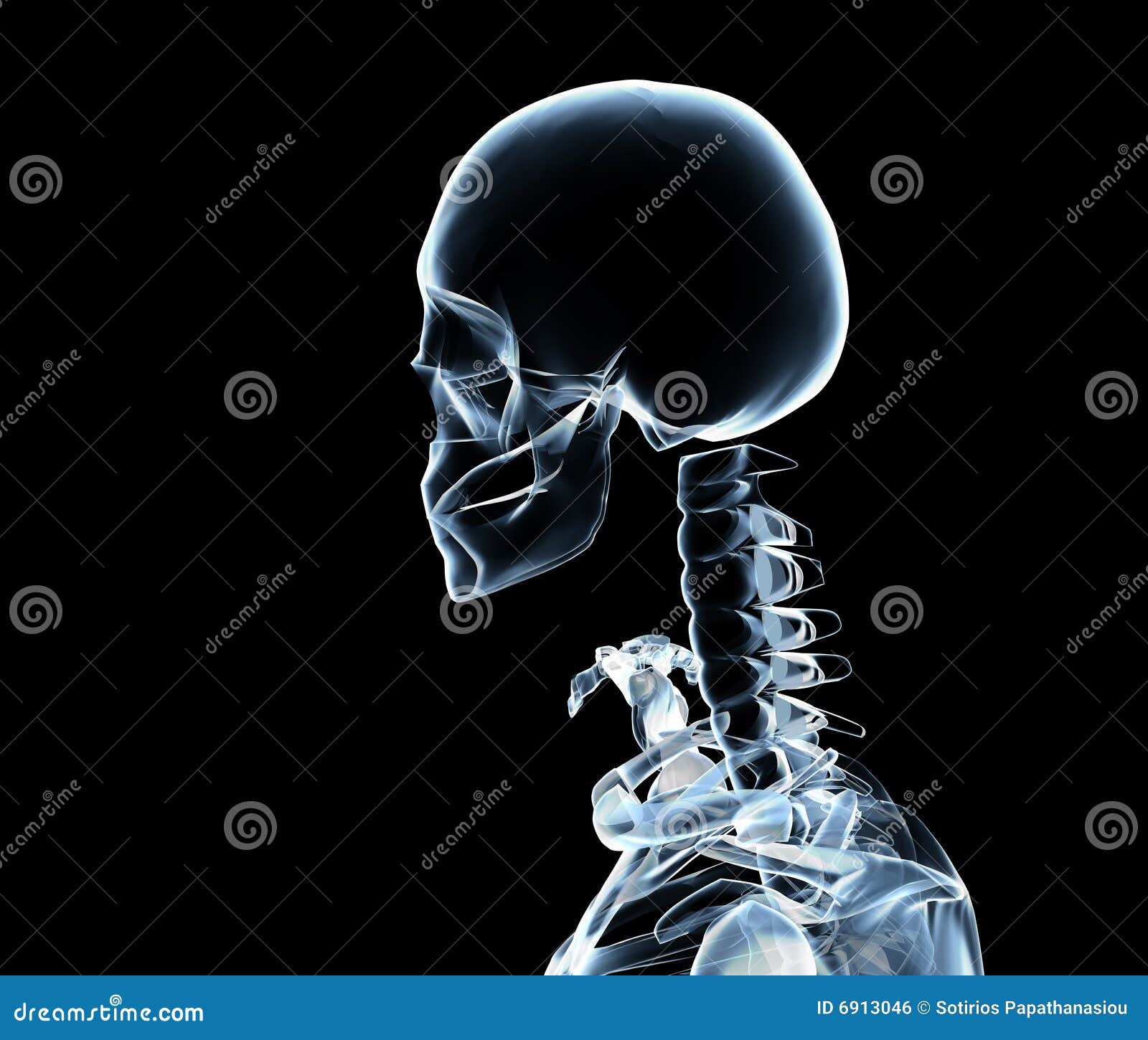 Head x-ray stock illustration. Illustration of bones, neck - 6913046