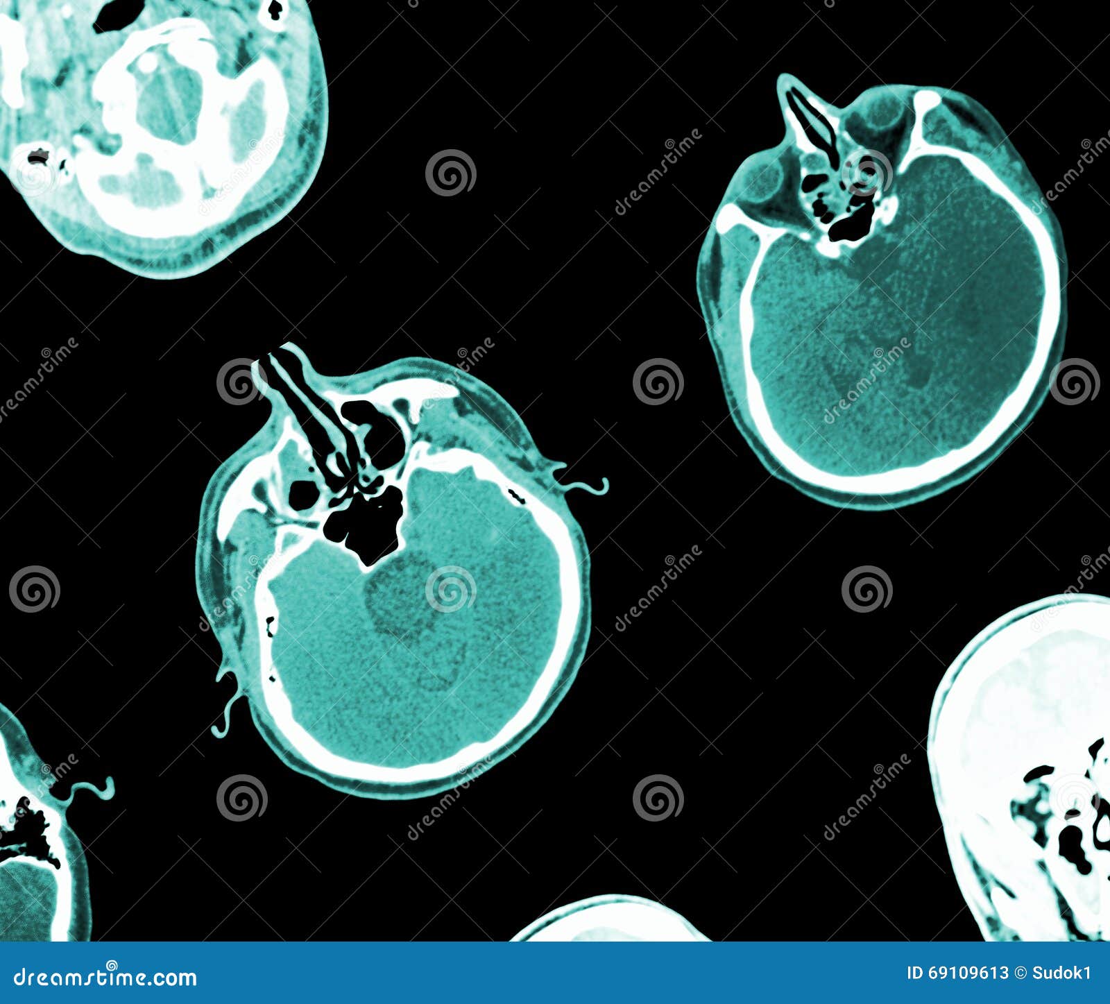 Head scan image stock image. Image of health, ideas, examination - 69109613
