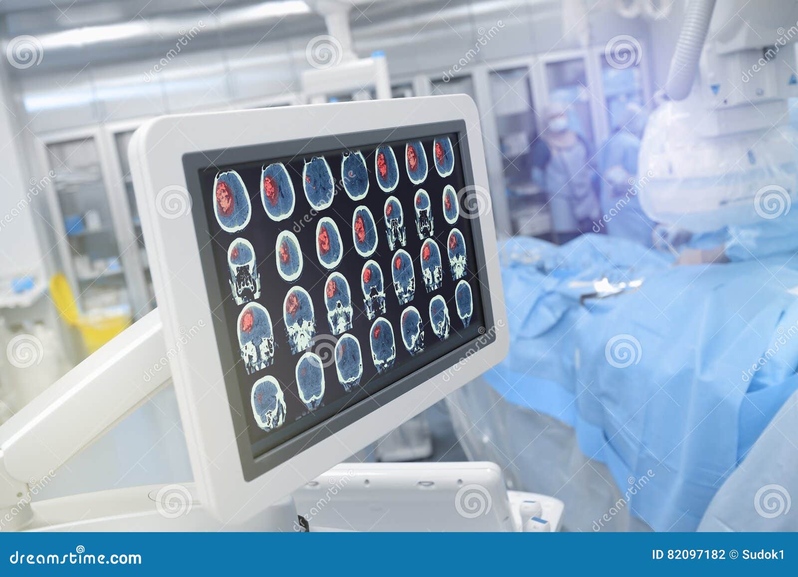Head Scan on the Monitor in Operating Theatre Stock Photo - Image of ...