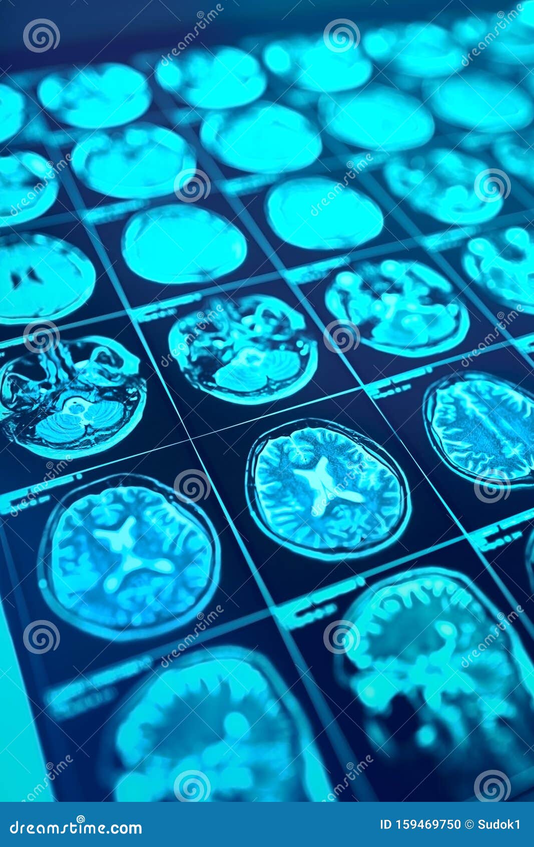 Head Scanning Series with Brain Structure Stock Photo - Image of ...
