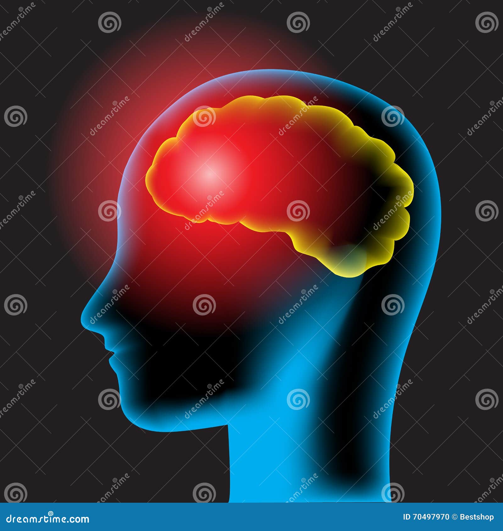 Headache stock vector. Illustration of cortex, cerebellum - 70497970