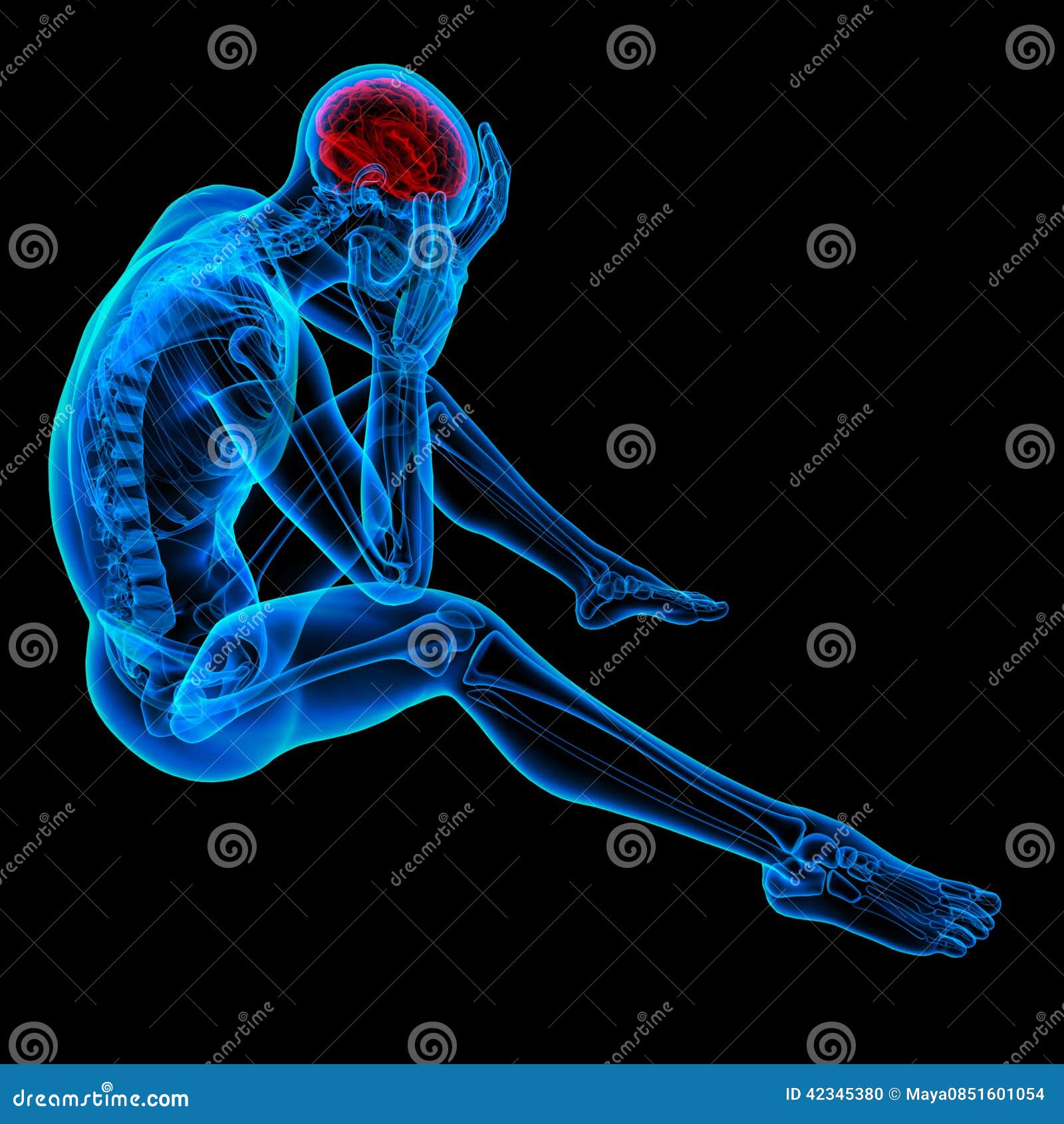 Headache stock illustration. Illustration of body, transparency - 42345380