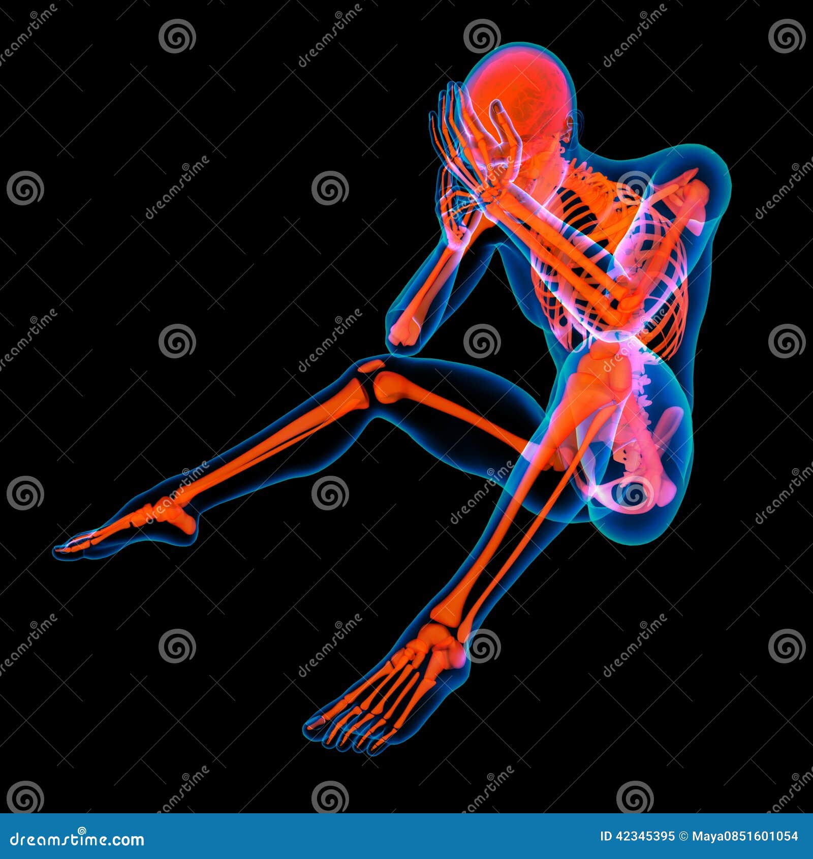 Headache stock illustration. Illustration of painful - 42345395