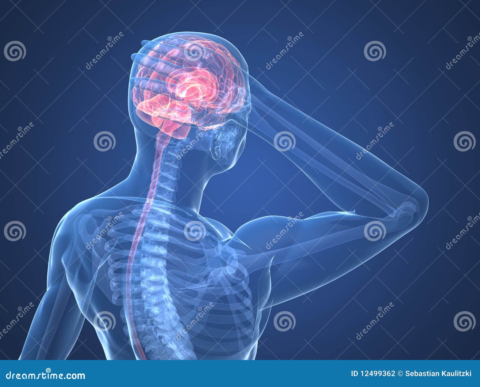 Headache/migraine Illustration Stock Illustration - Illustration of ...