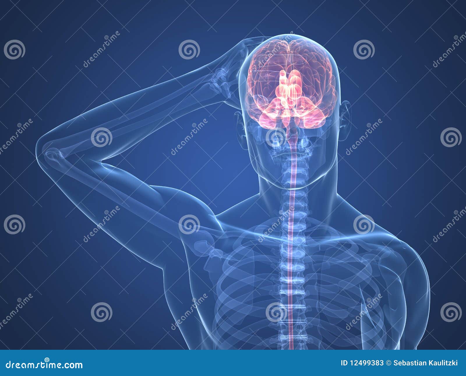Headache/migraine Illustration Stock Illustration - Illustration of ...