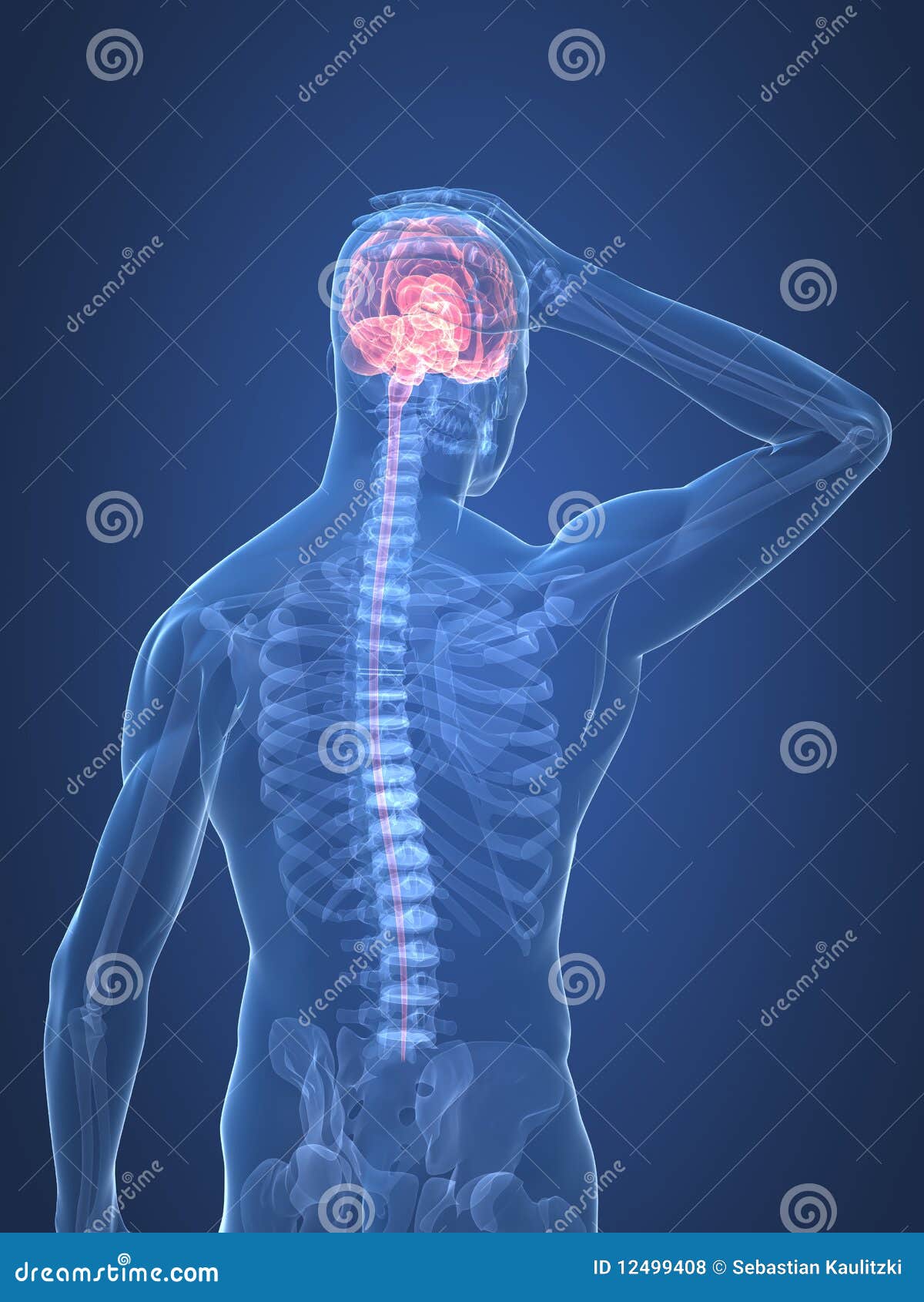 Headache/migraine Illustration Stock Illustration - Illustration of ...