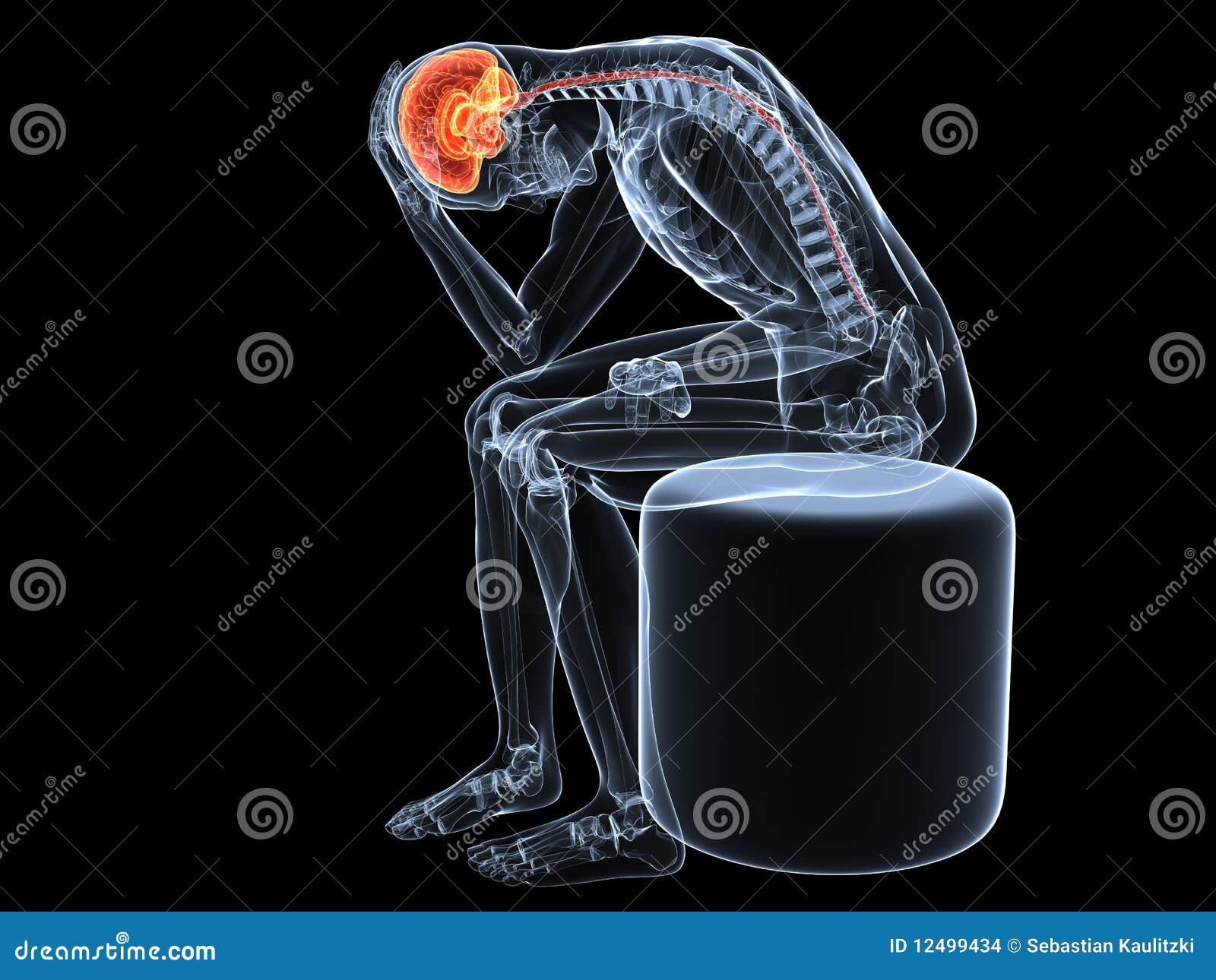 Headache/migraine Illustration Stock Illustration - Illustration of ...