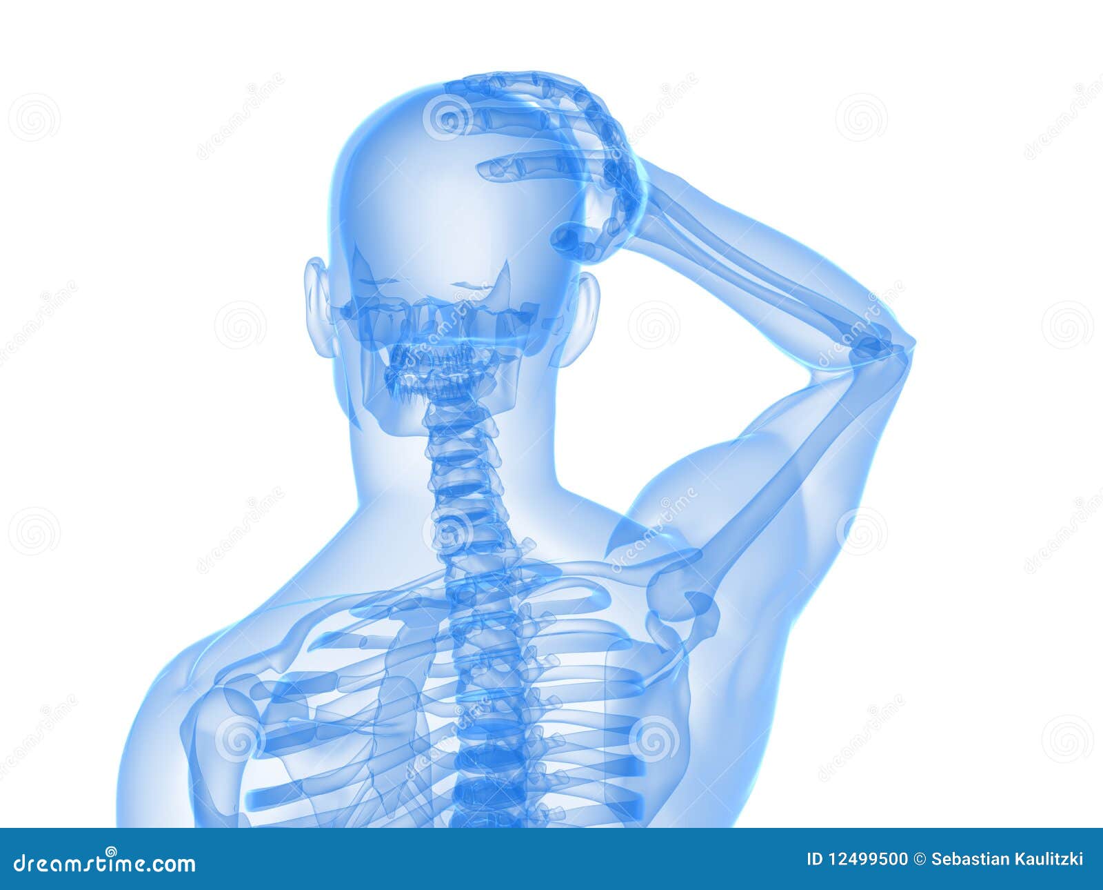 Headache/migraine Illustration Stock Illustration - Illustration of ...