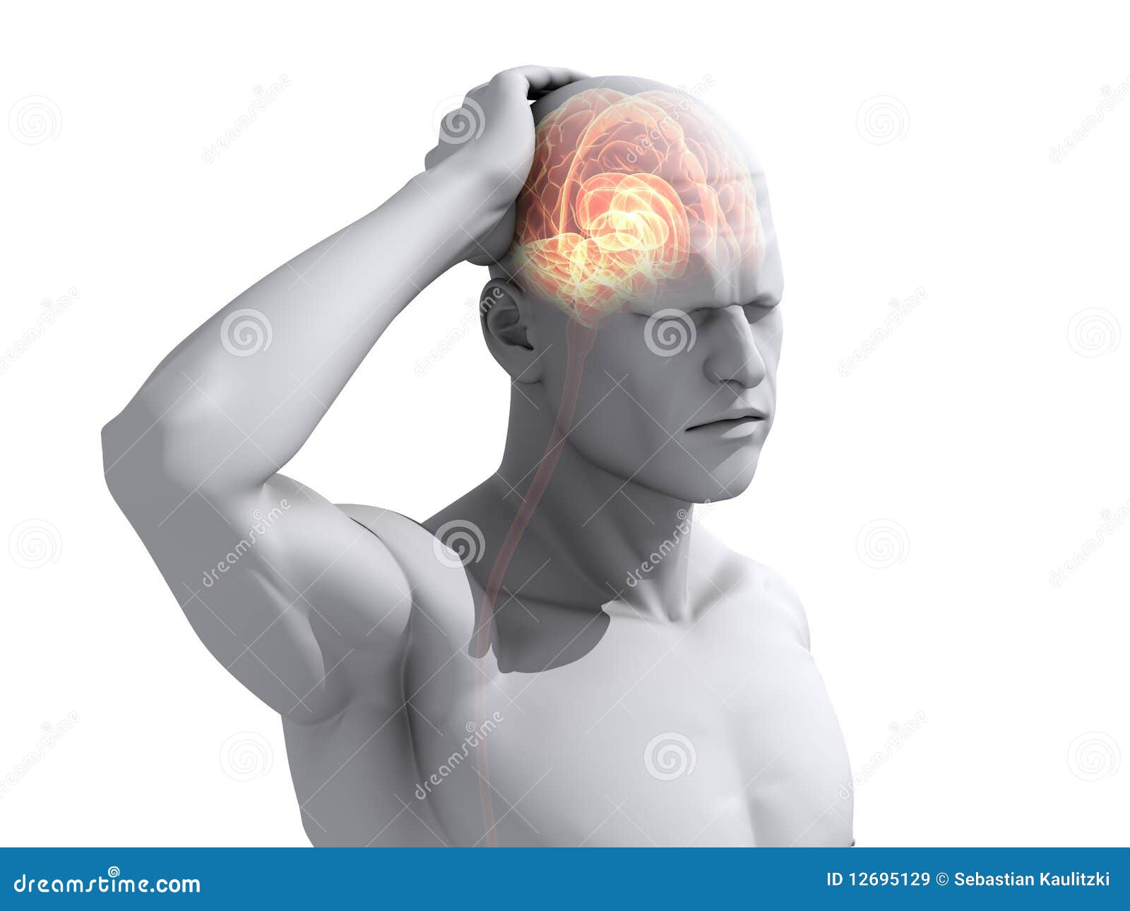 Headache/migraine Illustration Stock Illustration - Illustration of ...