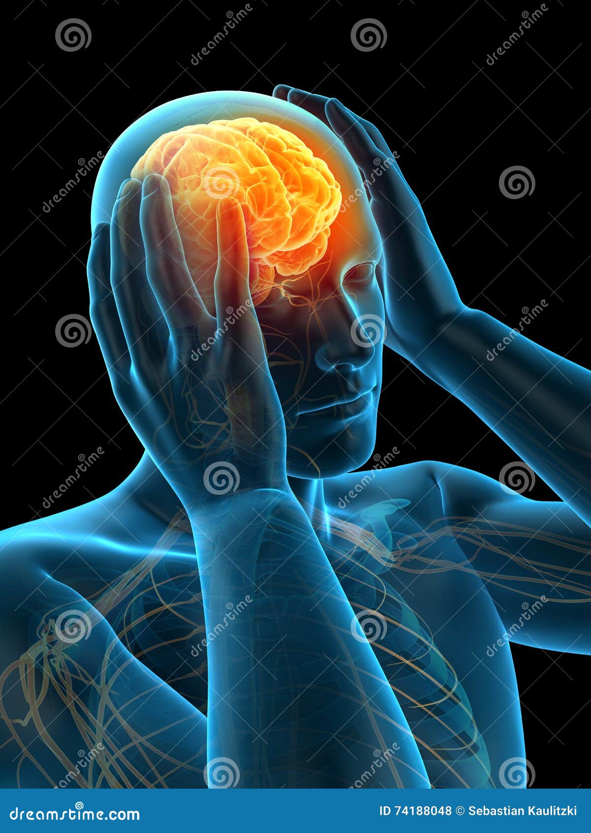 Headache Migraine Logo Human Brain Cracks Red Heartbreak Broken Heart ...