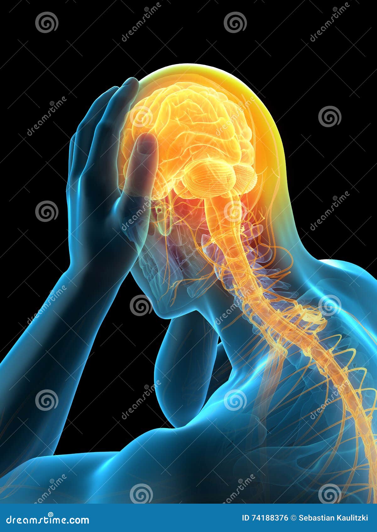 Headache, Migraine Of A Woman, Medically 3D Illustration On Blue ...