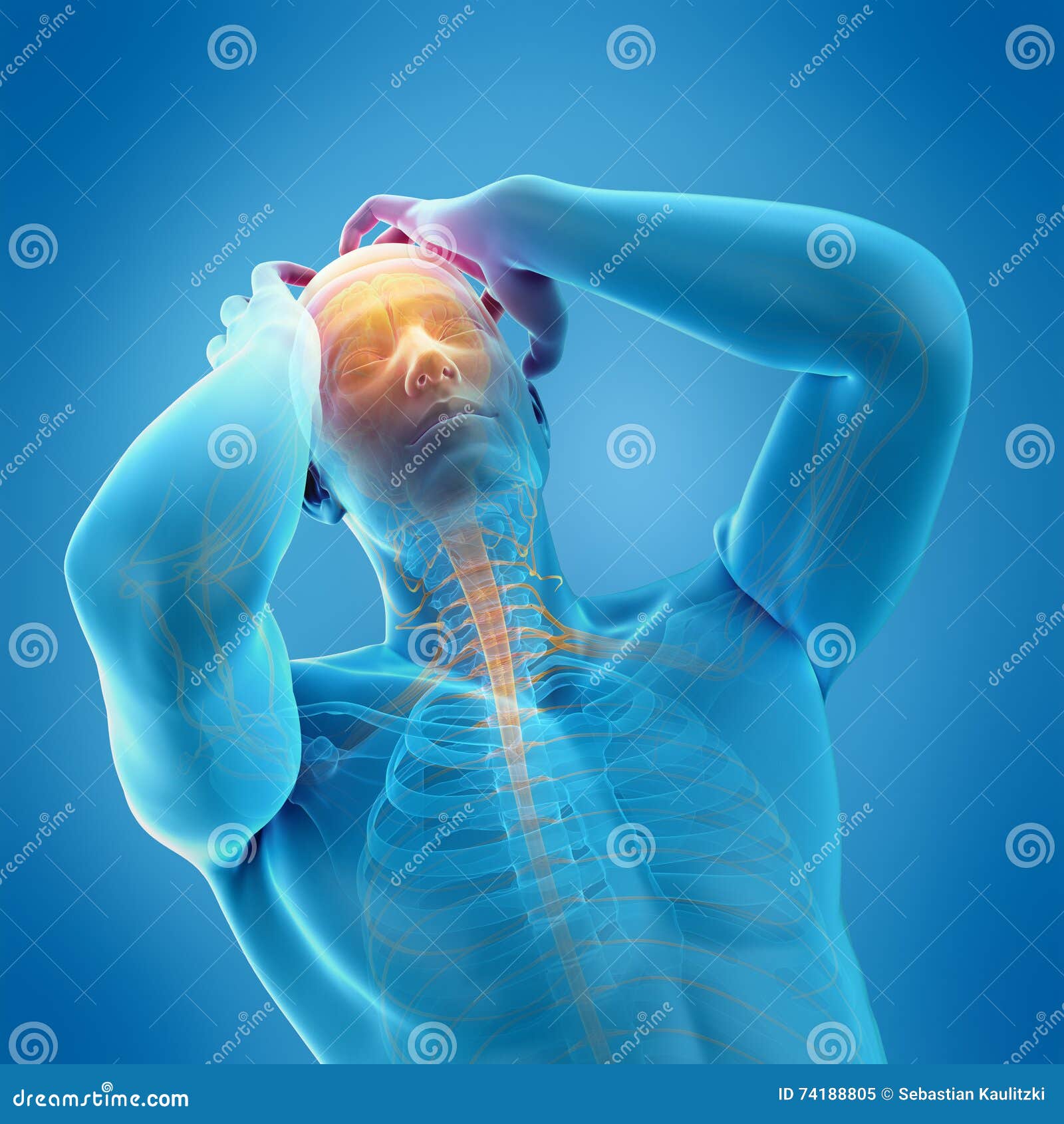 Headache, Migraine Of A Woman, Medically 3D Illustration On Blue ...