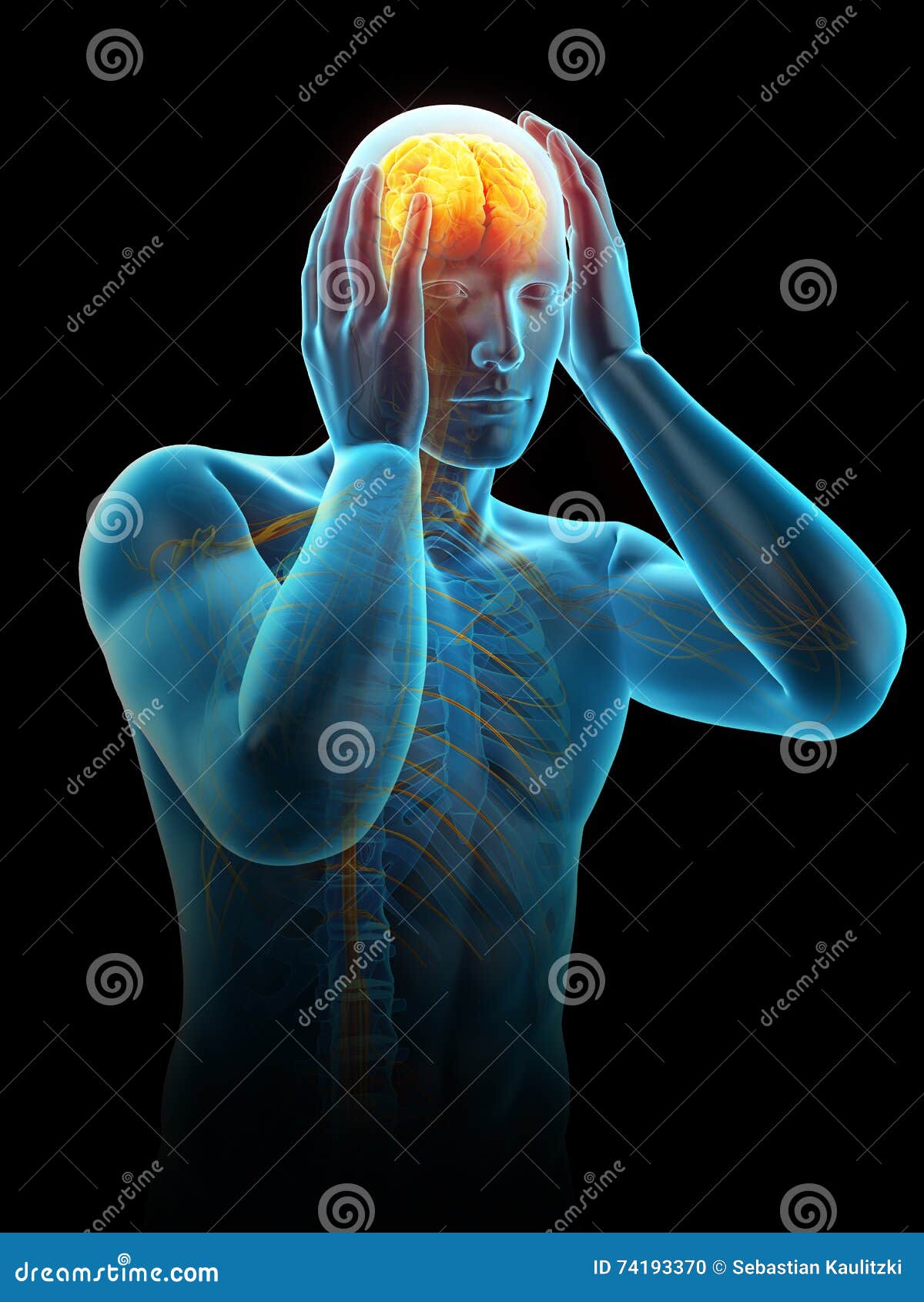 Headache, Migraine Of A Woman, Medically 3D Illustration On Blue ...