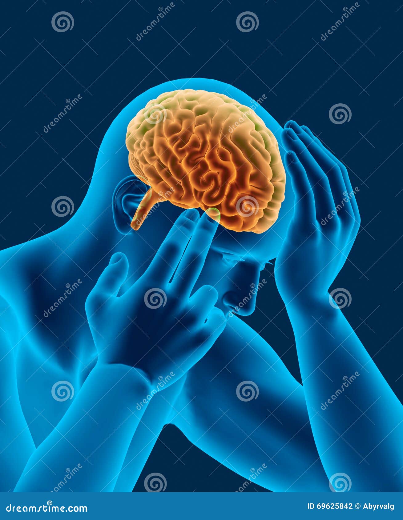 Headache X-ray Scan of Human Head with Brain Side View Stock ...