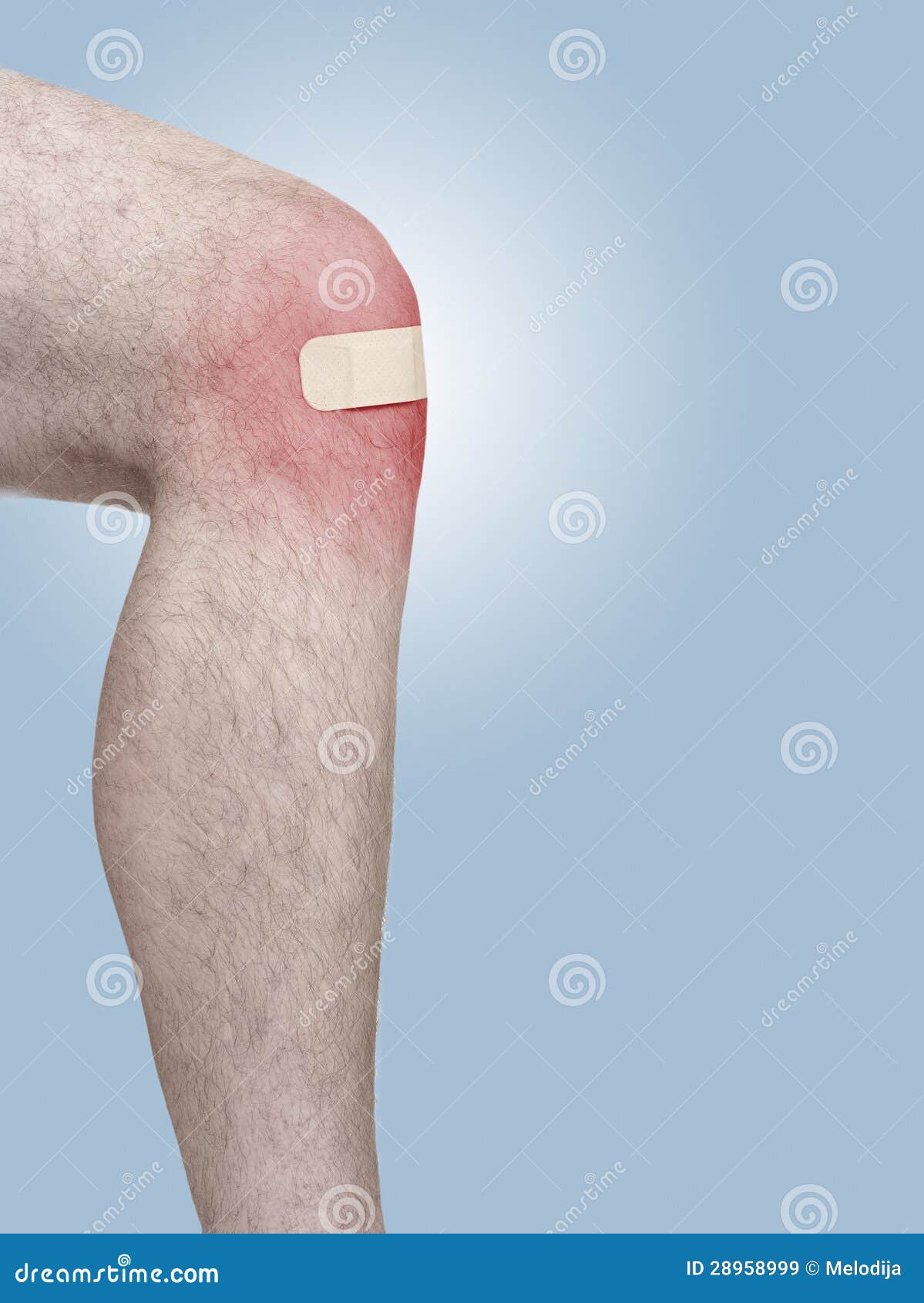 Healing plaster on knee. stock image. Image of injury - 28958999