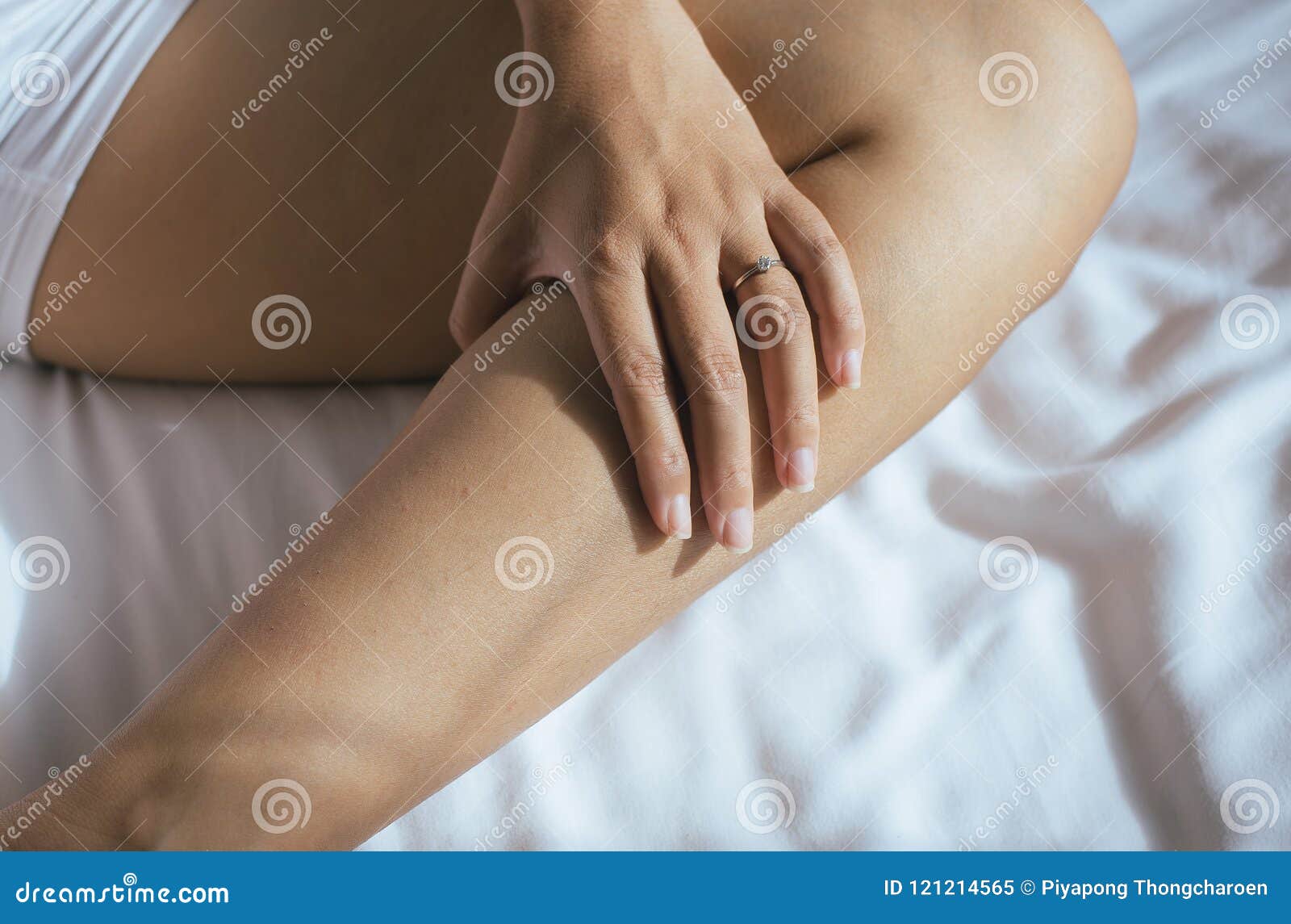 Health Allergy Skin Care Problemwoman With Rash Or Papule On Her Leg From Allergies Stock Image