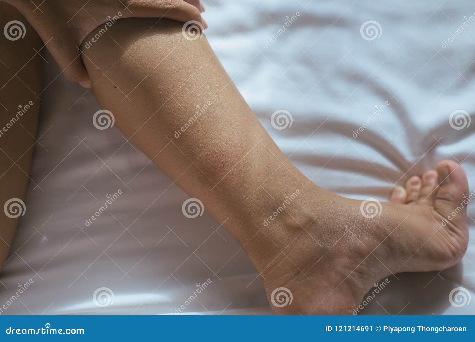 Woman With Rash And Scratching Her Leg From Allergies Health Allergy