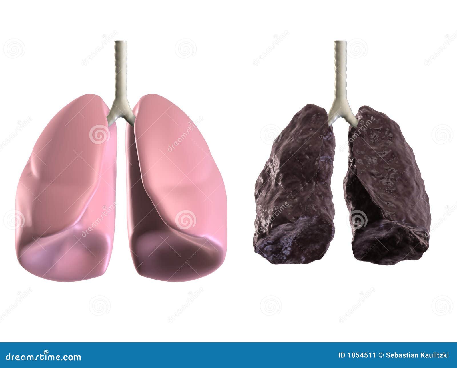 Health and bad lungss stock illustration. Illustration of stomach - 1854511