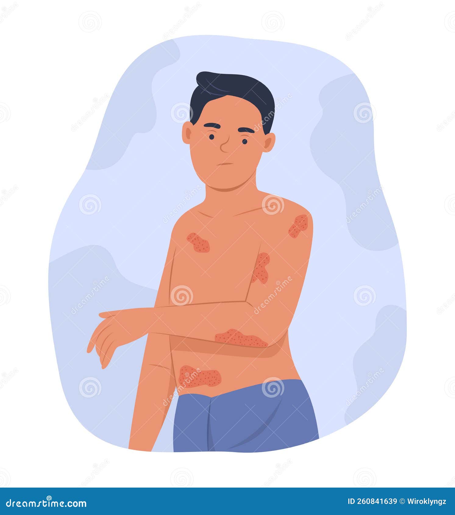 Dermatitis On Body With Redness, Rashes, And Texture Changes Stock ...