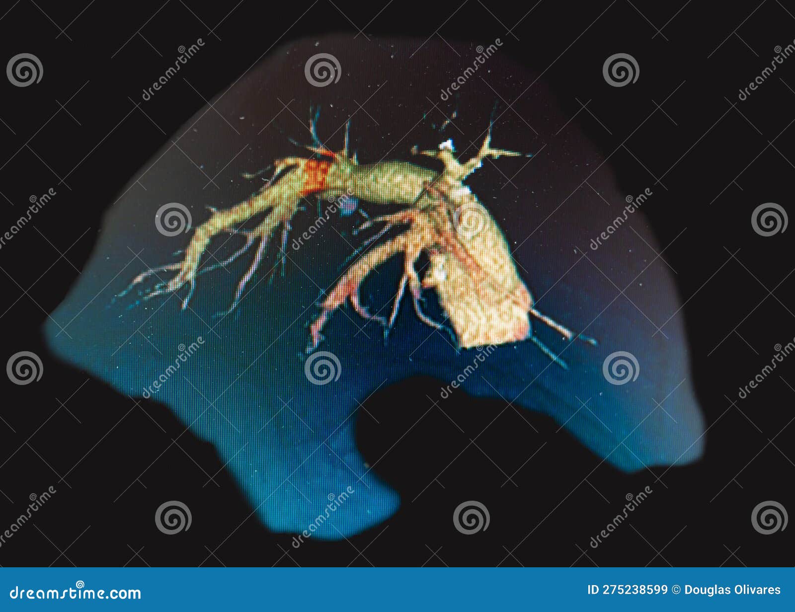 Pulmonary Artery Ct Angiography Stock Image Image Of Scanning