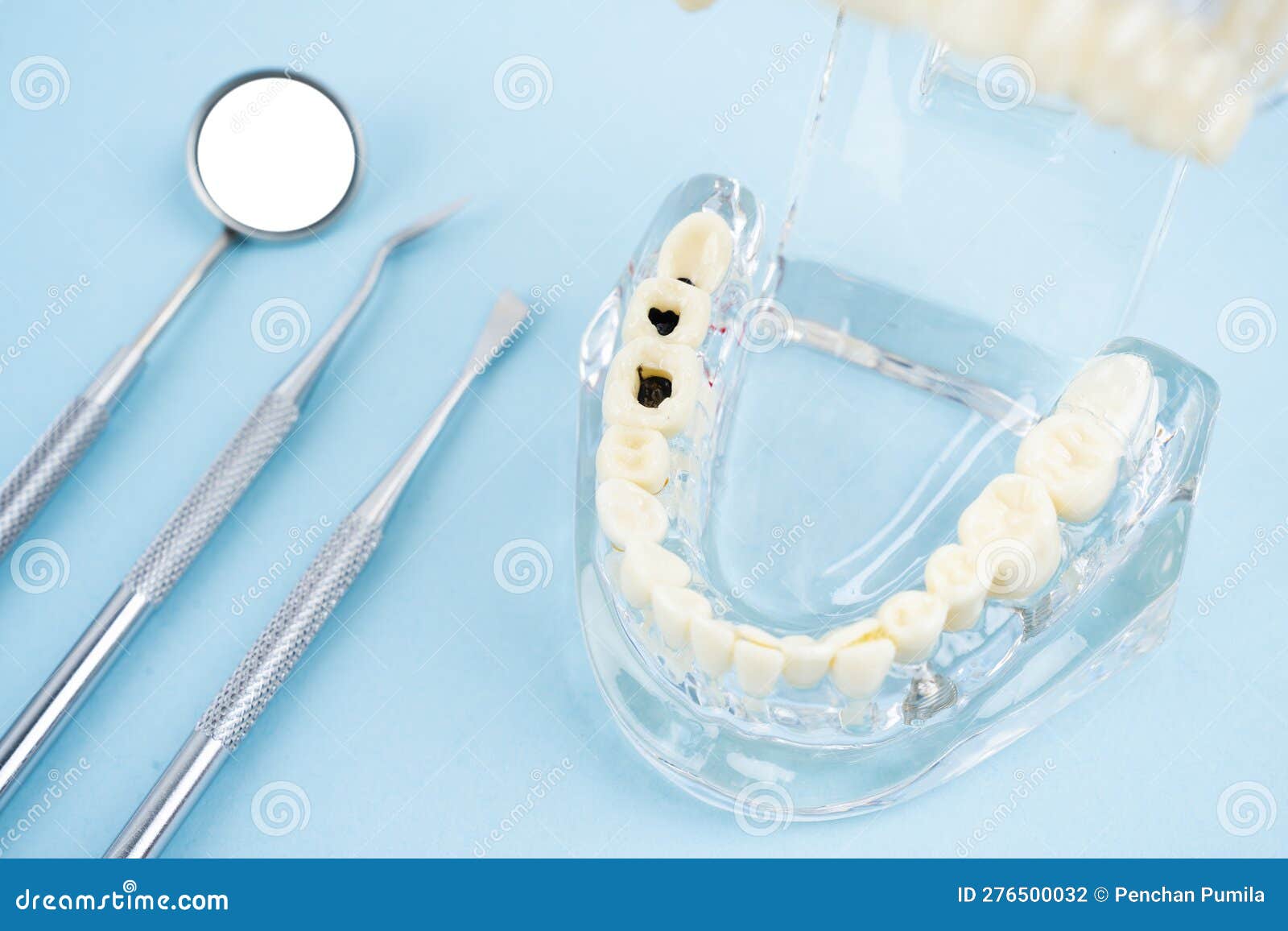 The Healthy and Decayed Teeth Model and Mouth Mirror, Dental Concepts ...
