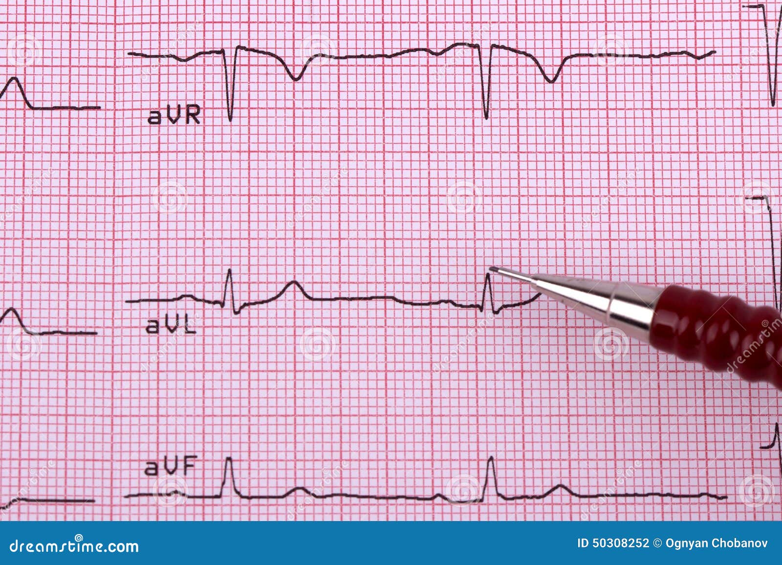 Healthy Heart cardiogram stock illustration. Illustration of pattern ...