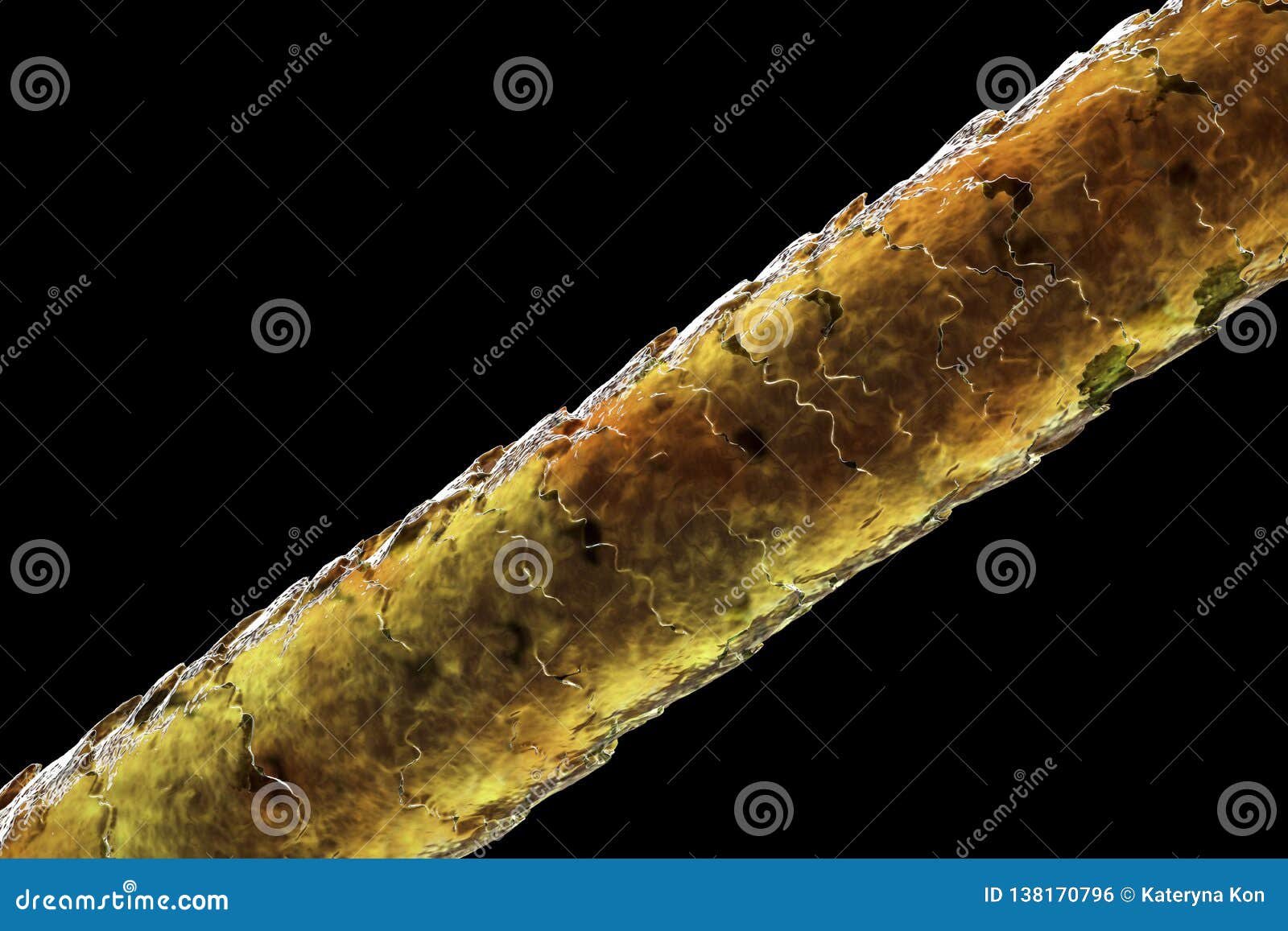 Human Hair Growth. Life Cycle Of Hair Follicle. Phases Anagen, Catagen ...