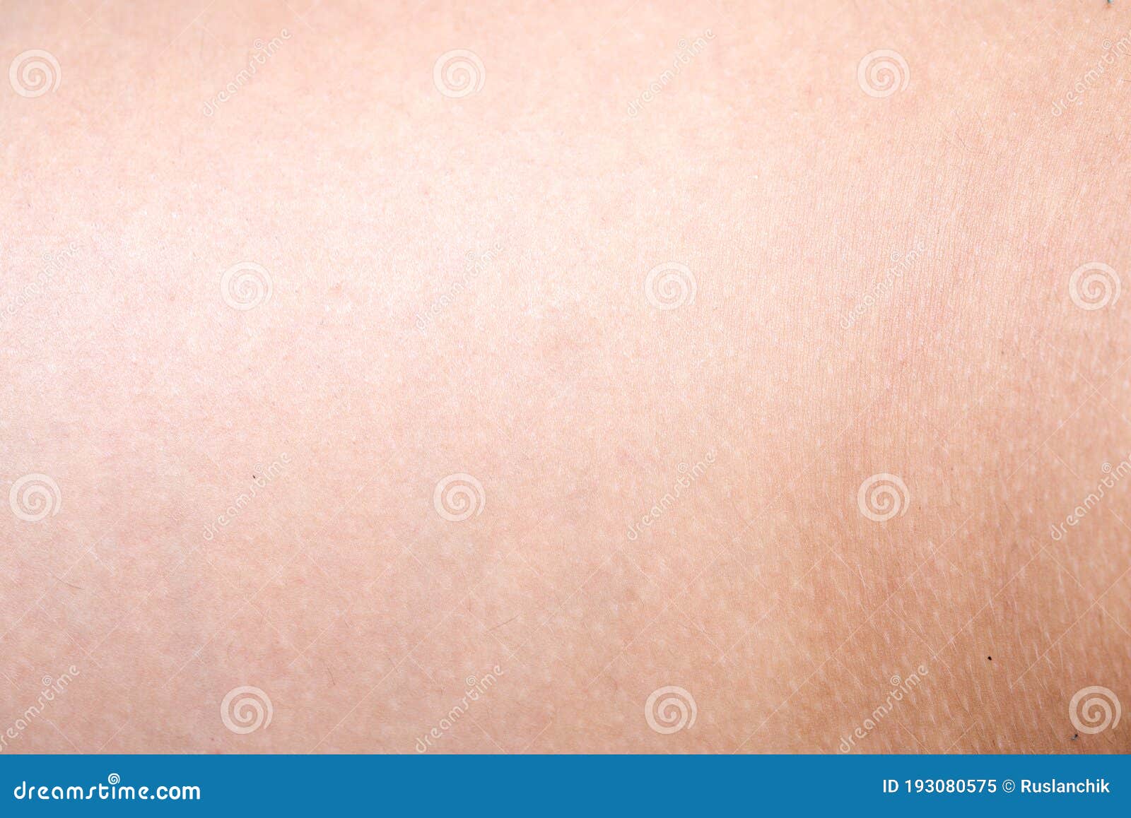 Skin texture stock image. Image of covering, flat, complexion - 193080575