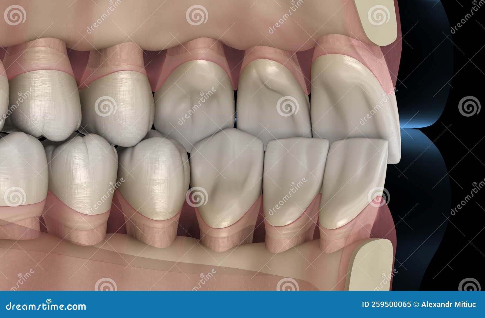 Healthy Human Teeth with Normal Occlusion, 3D Illustration Stock ...