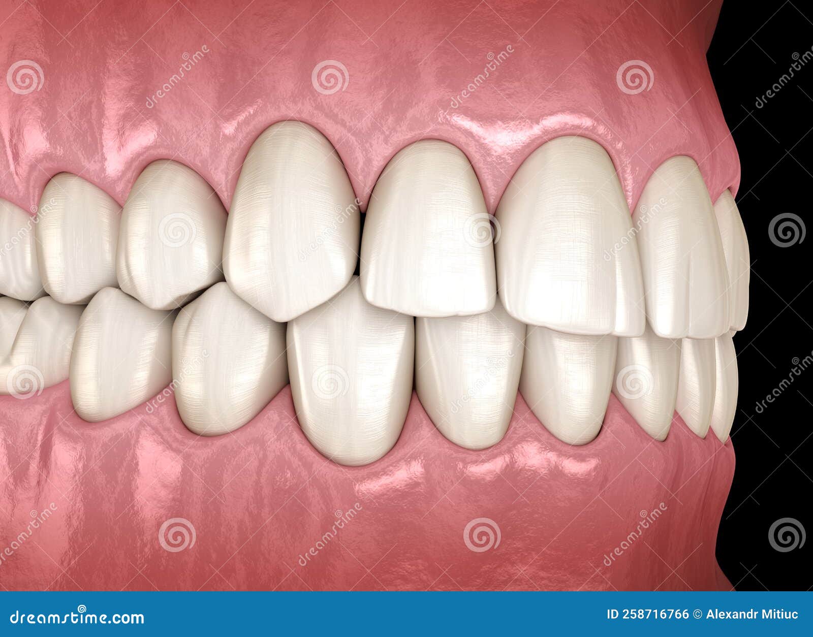 Healthy Human Teeth with Normal Occlusion. Stock Illustration ...