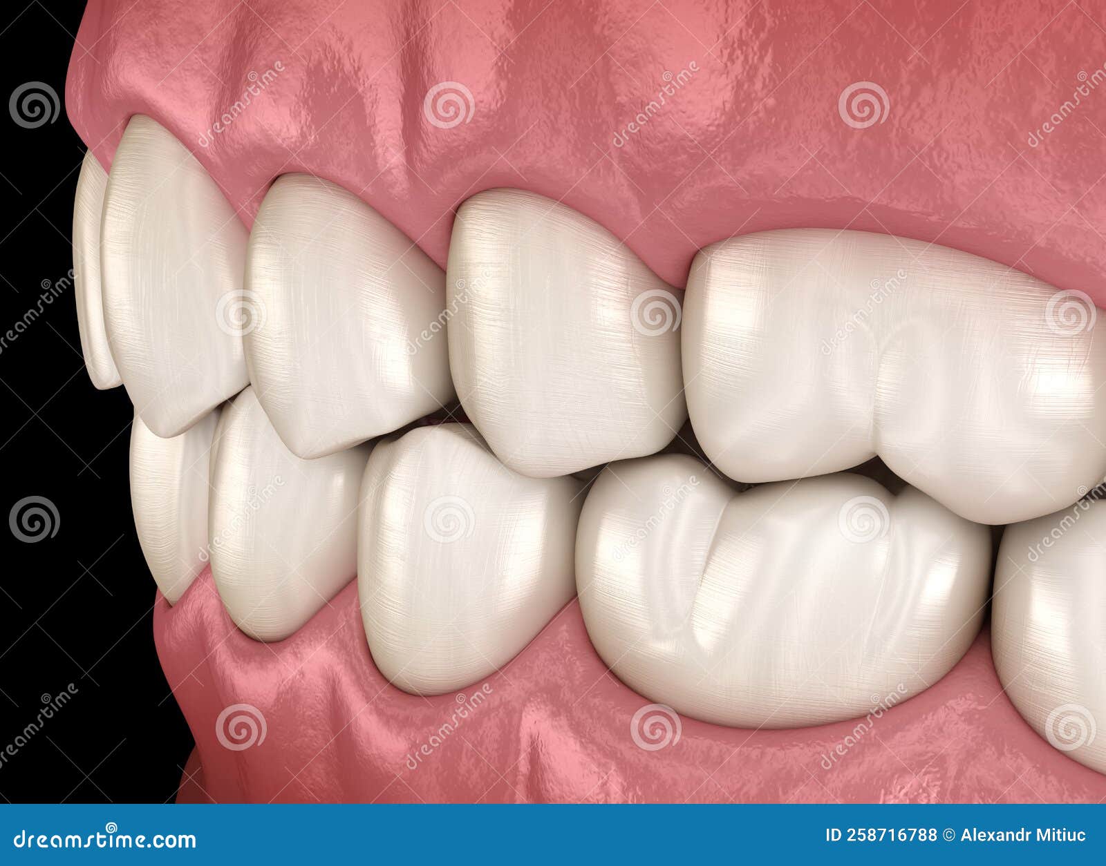 Healthy Human Teeth with Normal Occlusion. Stock Illustration ...