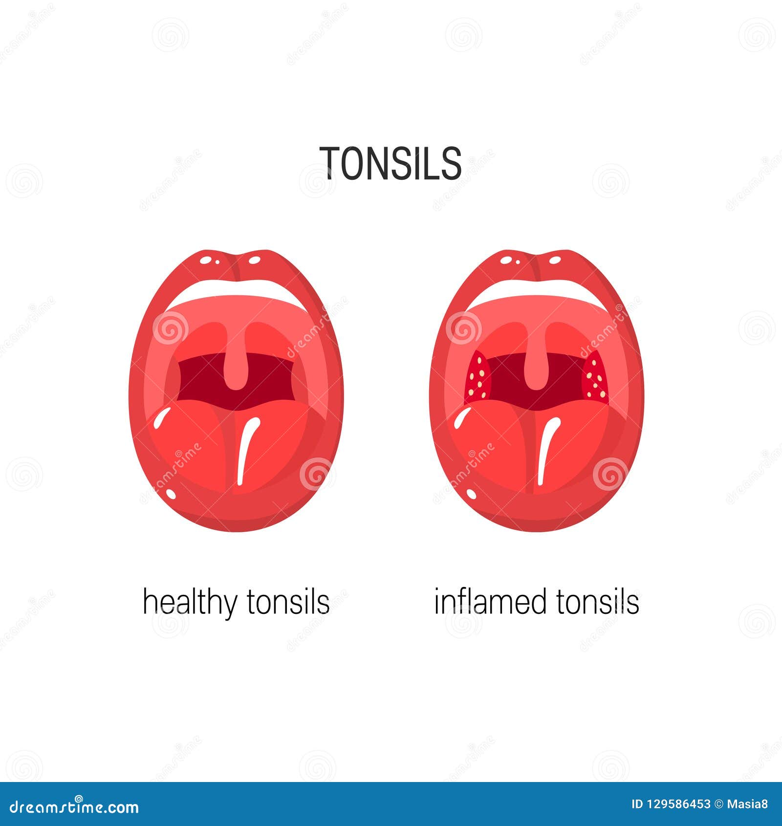 TONSILS Background Writing Vector Design | CartoonDealer.com #240344755