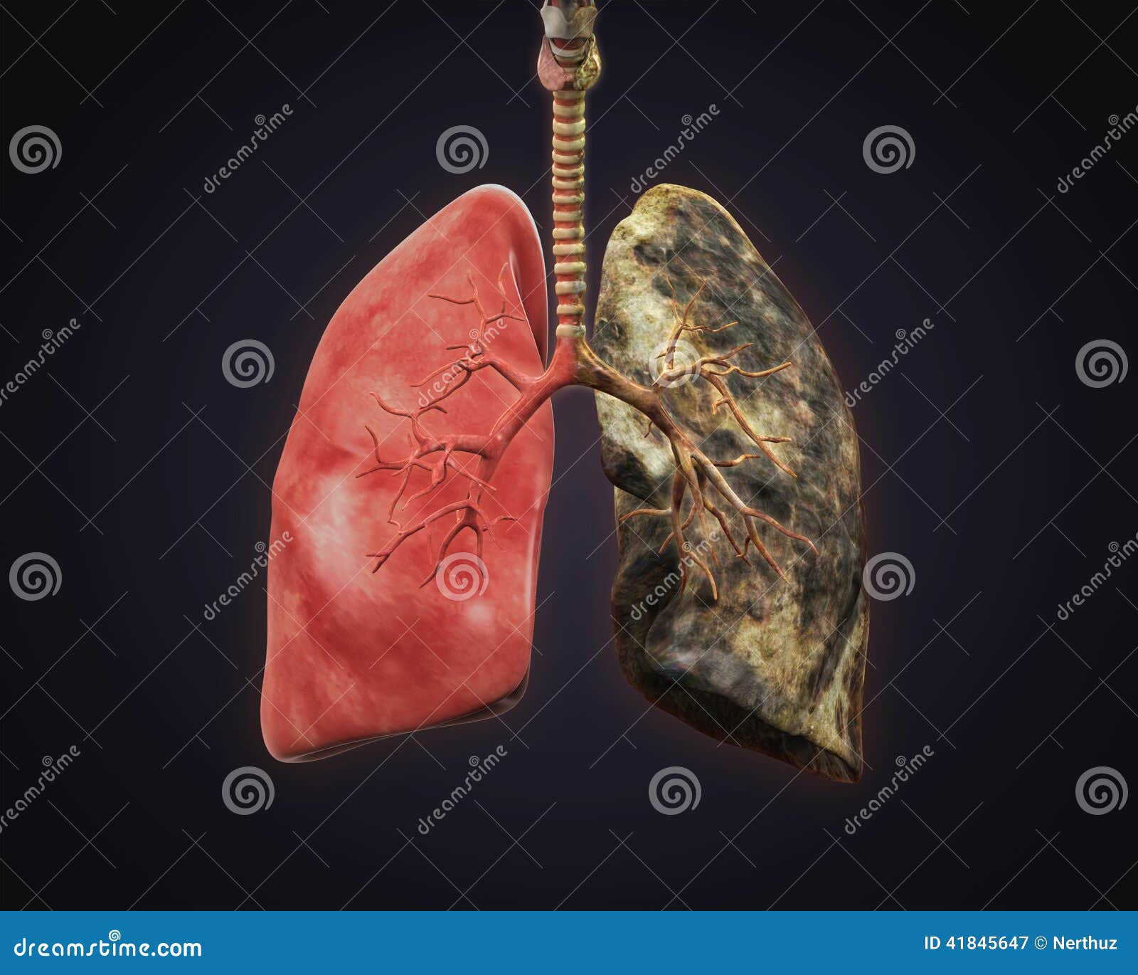 Smokers Body Stock Illustrations – 77 Smokers Body Stock Illustrations ...