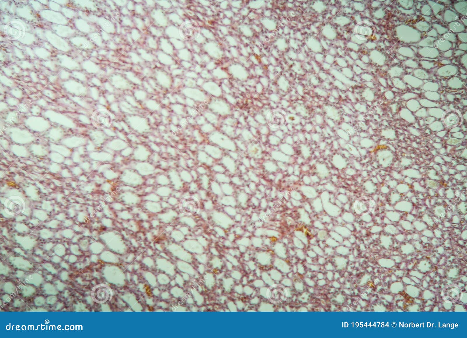 Healthy Lung Tissue with Alveoli Stock Photo - Image of healing ...