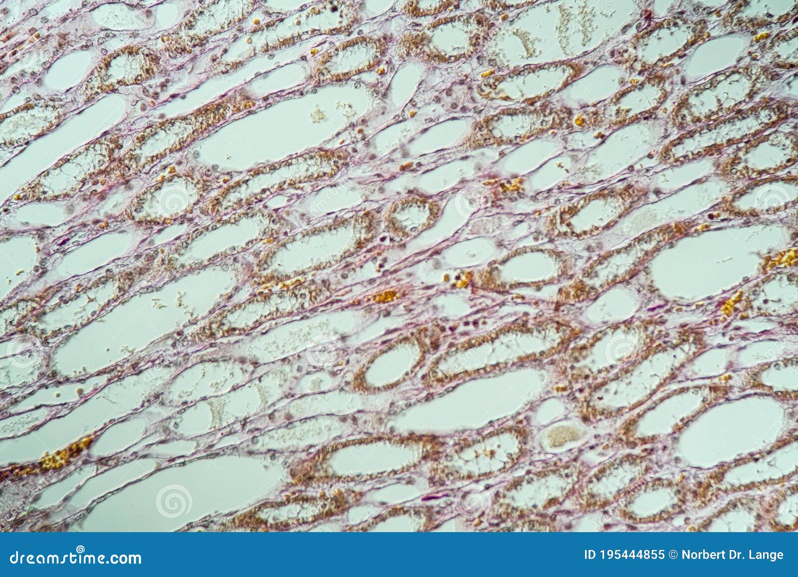 Healthy Lung Tissue with Alveoli Stock Image - Image of small, medicine ...