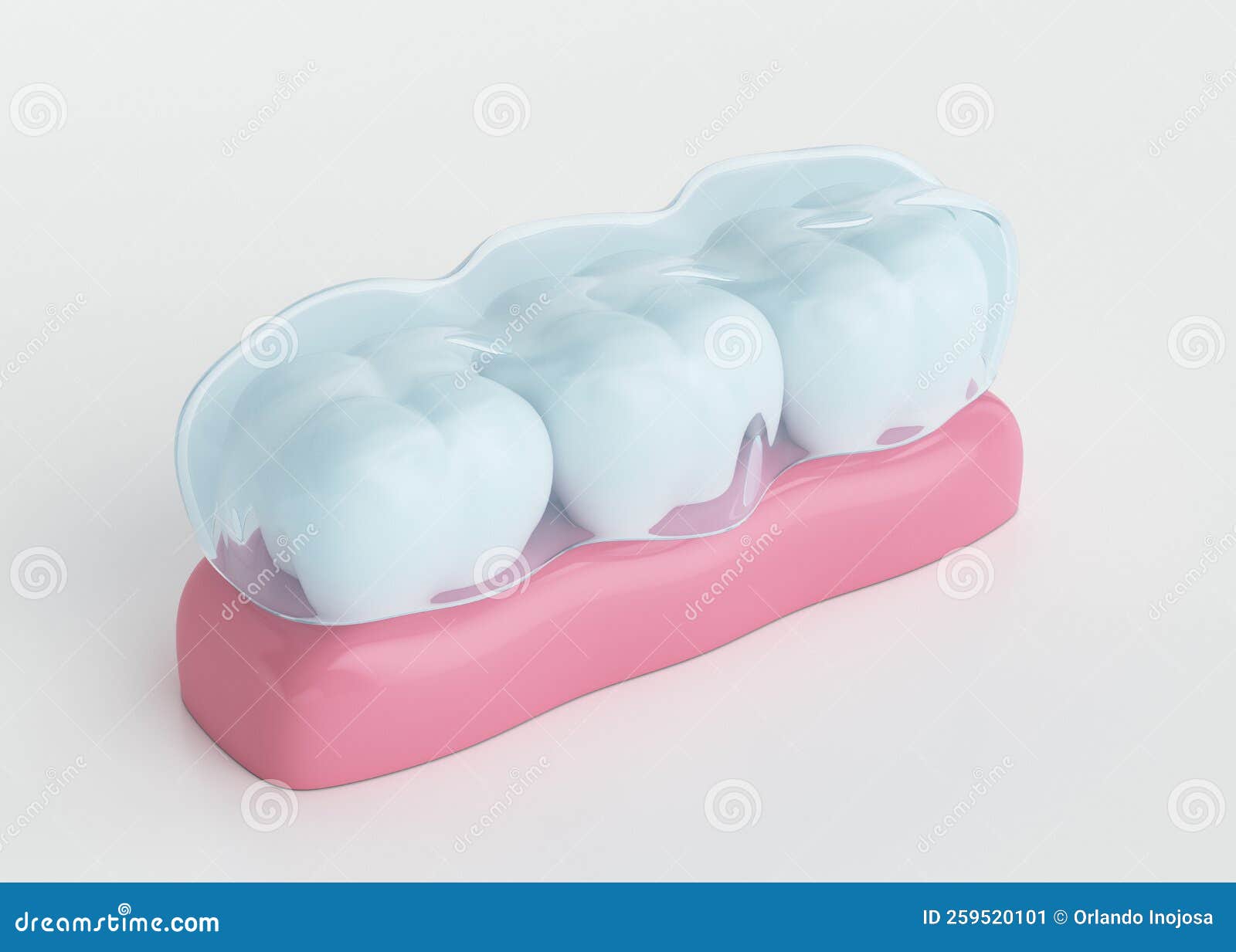Teeth Using Invisible Orthodontics Stock Image | CartoonDealer.com ...