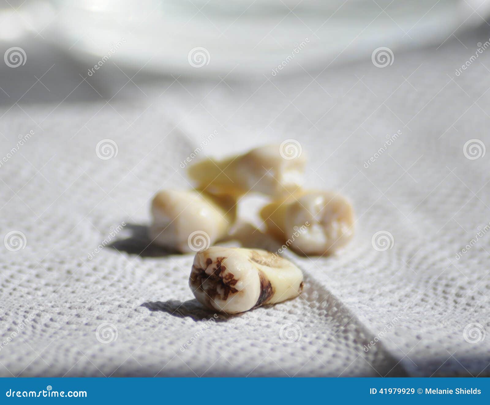 Cavity On Extracted Teeth Stock Photo | CartoonDealer.com #84086436