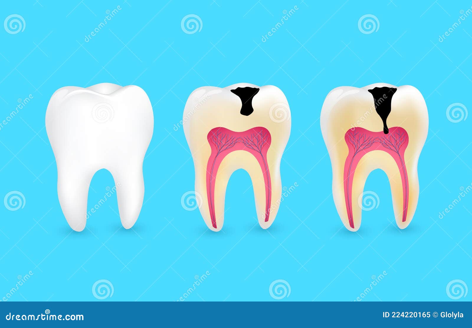 Superficial And Deep As Different Choices In Life - Pictured As Words ...