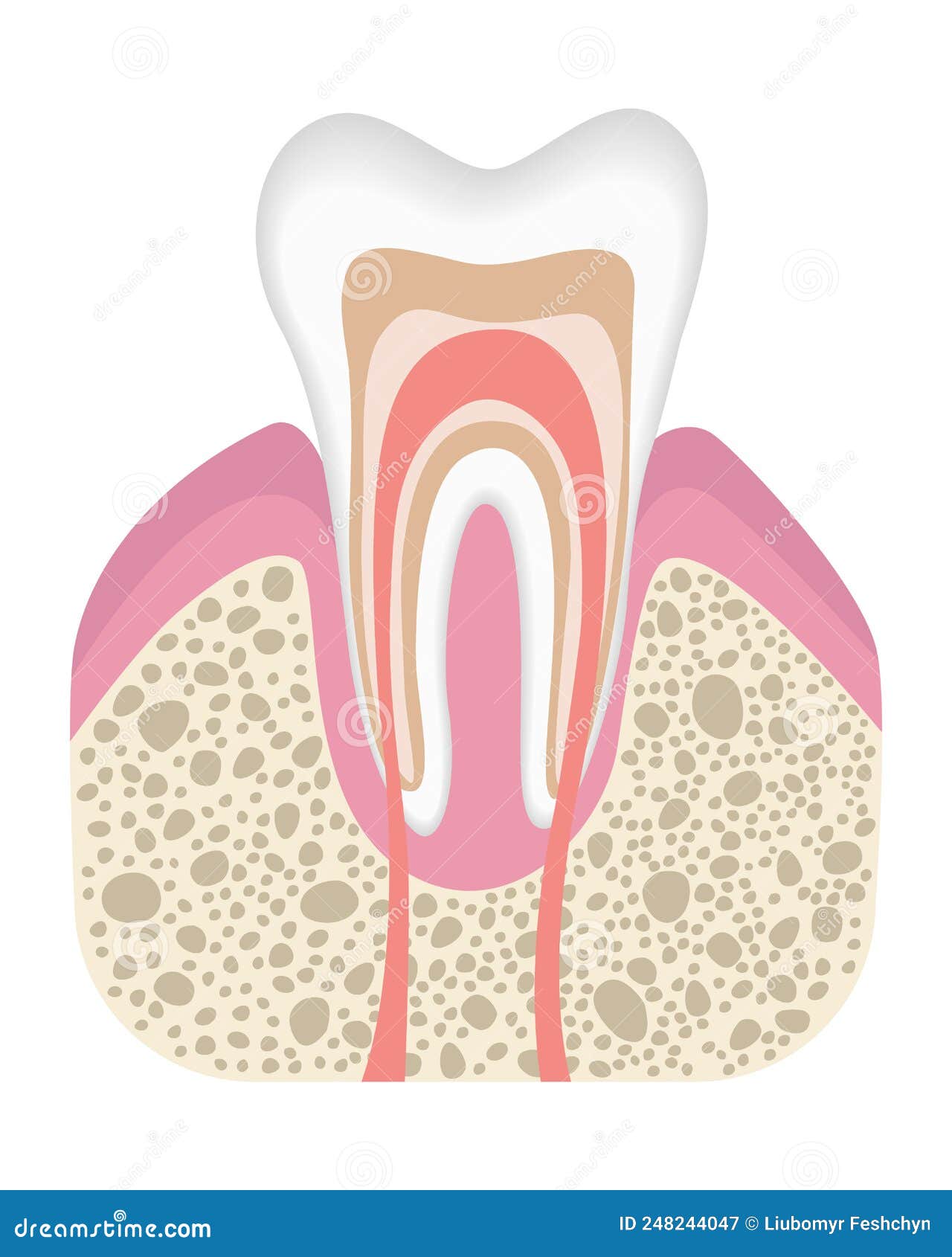 Stage Of Caries Development. Tooth Structure In Flat Style. Tooth Decay ...