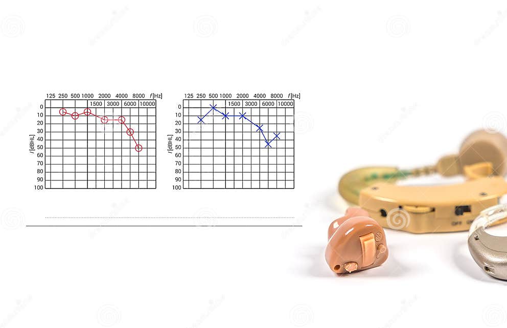 Hearing Aid with Audiogram Background Stock Photo - Image of wellbeing ...