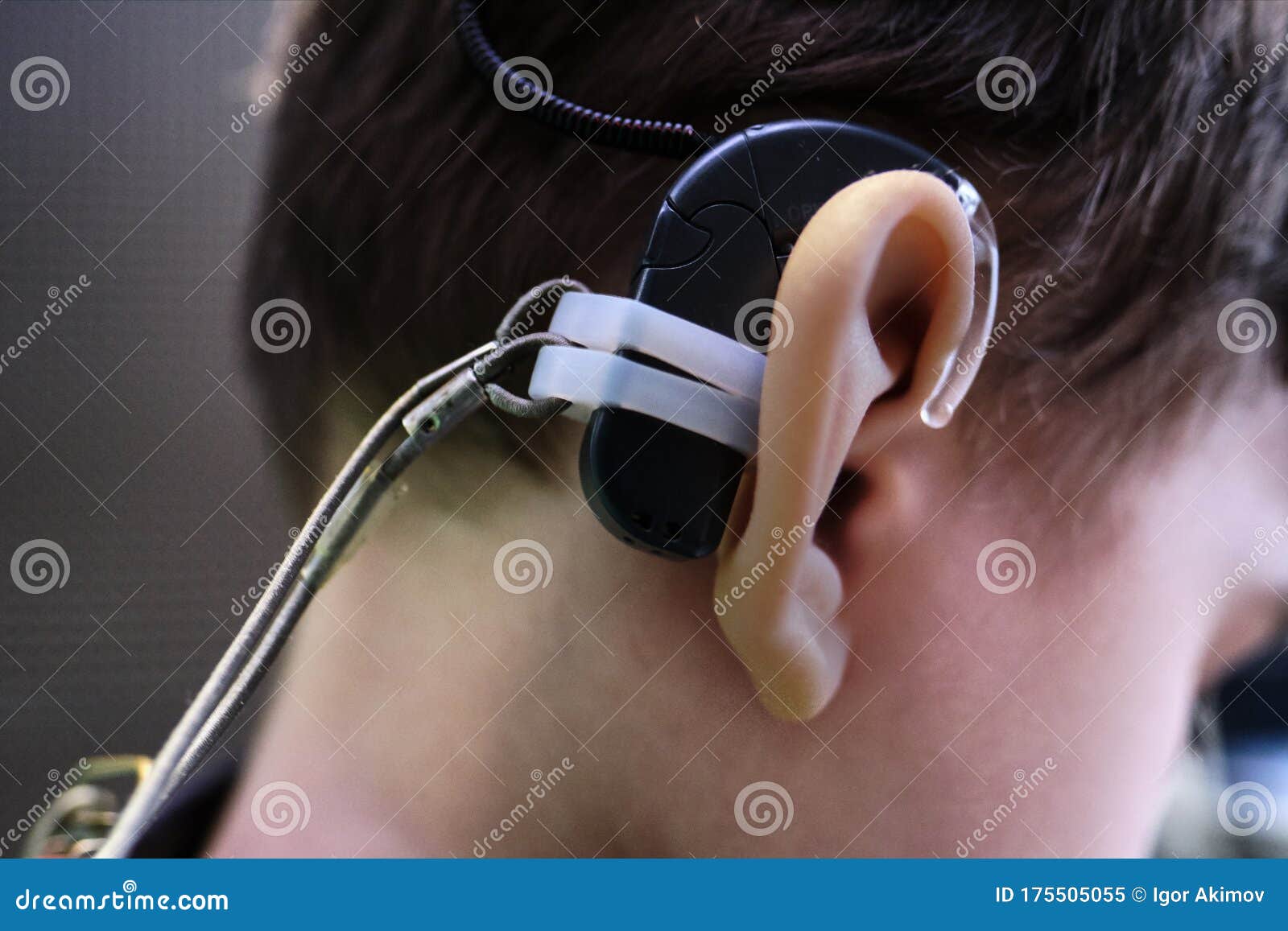 Hearing Aid in Boy`s Ear stock image. Image of hospital - 175505055