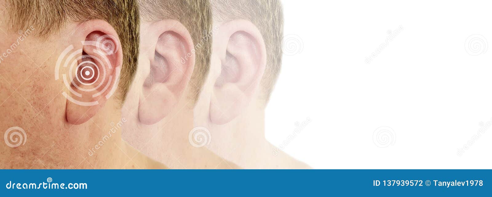 Hearing Loss Male Defect Symptom Stock Photo - Image of medical ...
