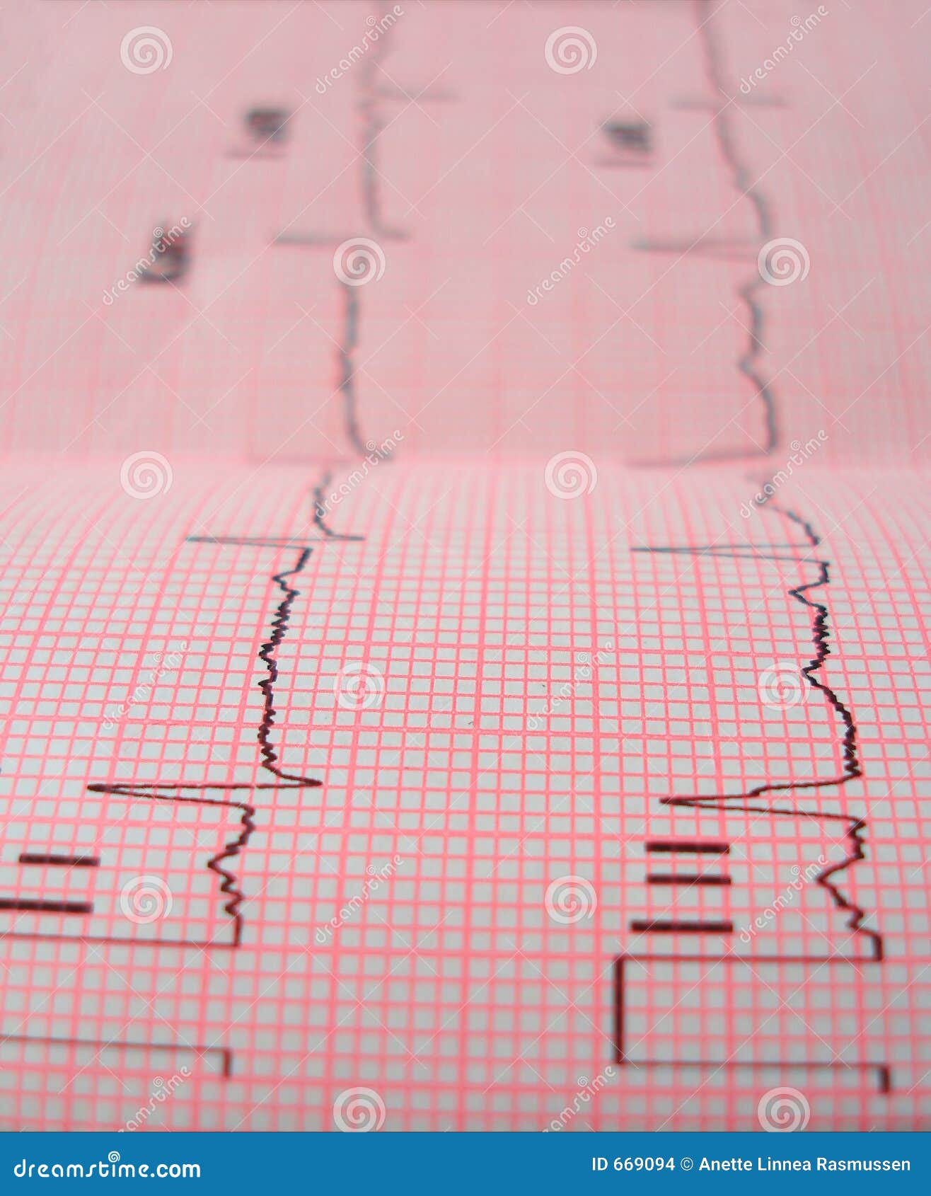 Heart Analysis, Electrocardiogram Graph (ECG) Stock Photography ...