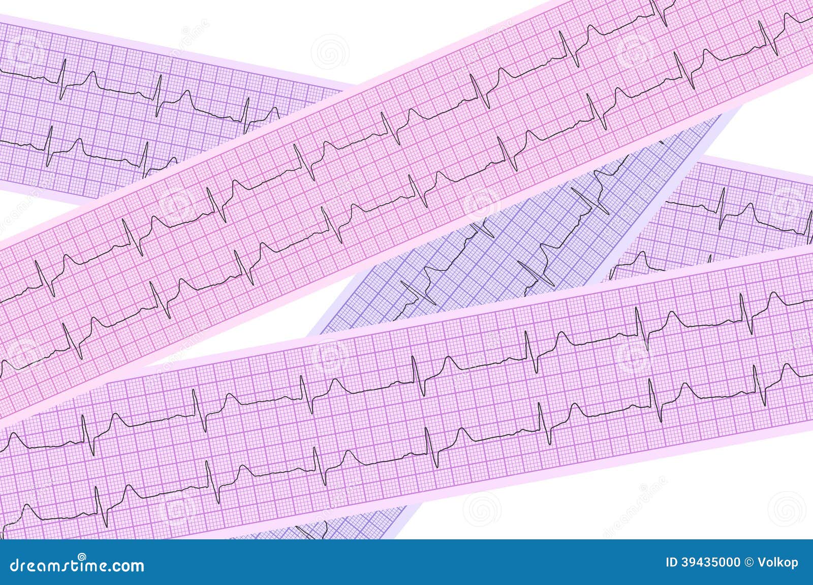 Heart Analysis, Electrocardiogram Graph Stock Photo - Image of health ...