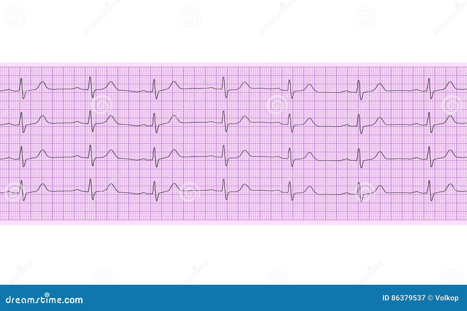 Heart Analysis, Electrocardiogram Graph (ECG) And Stethoscope Stock ...