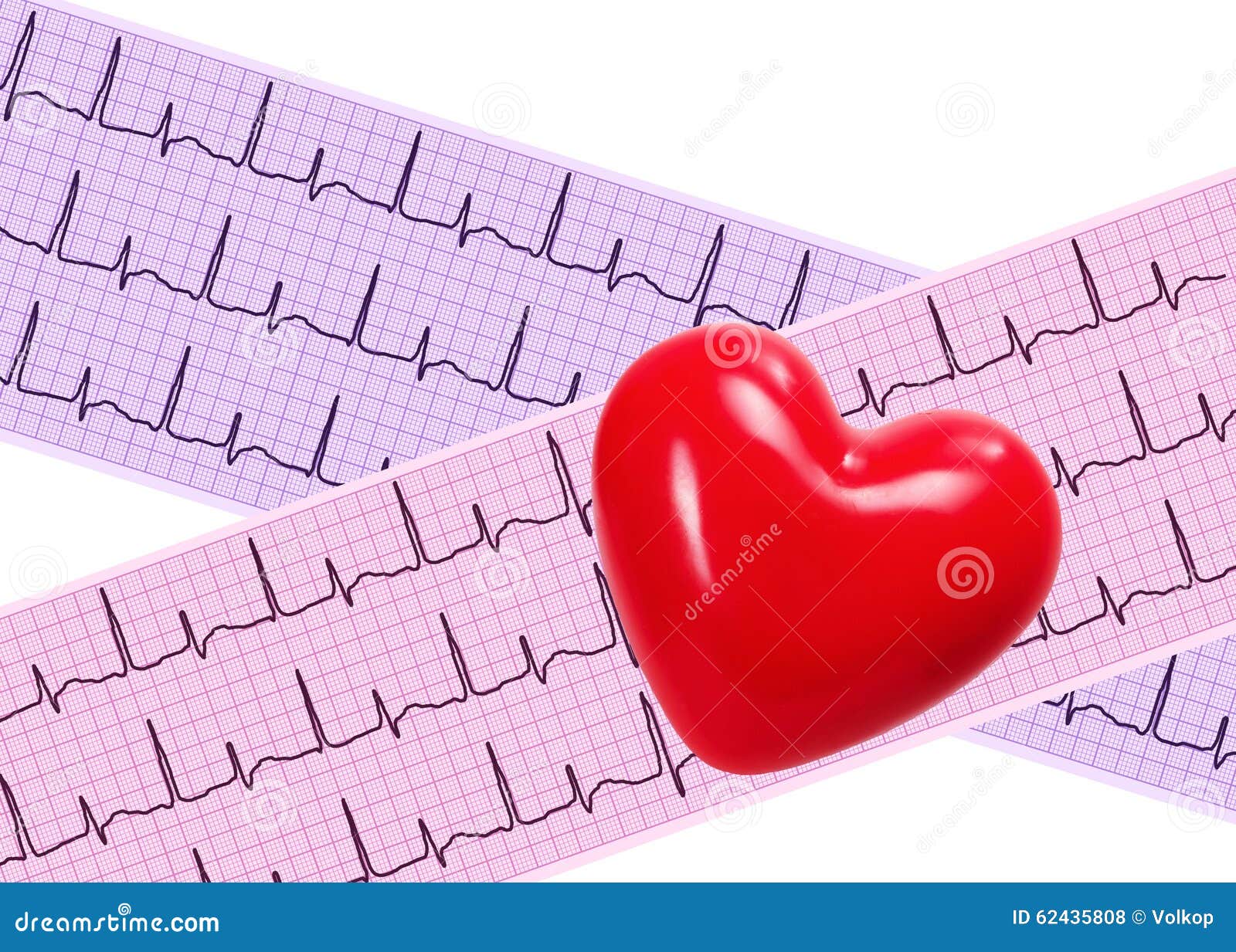 Heart Analysis, Electrocardiogram Graph (ECG) Stock Photography ...