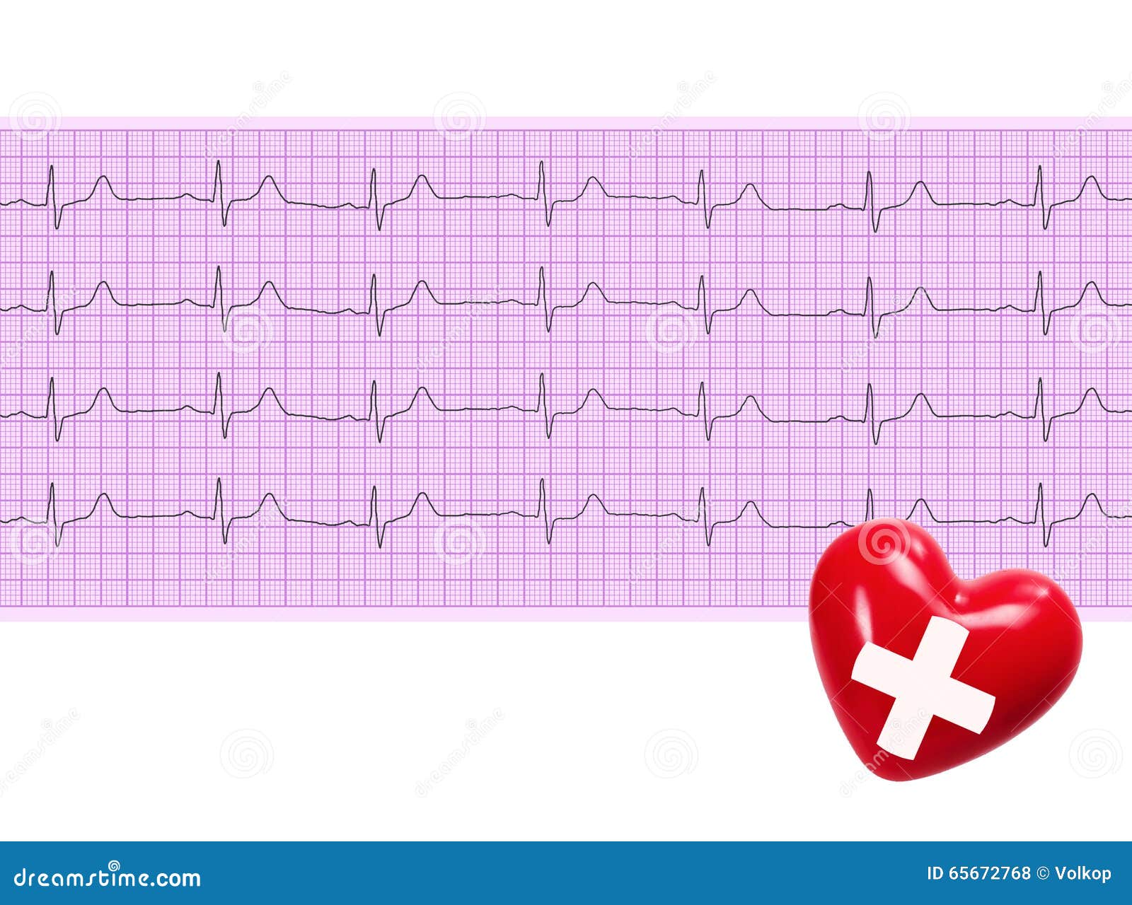 Heart Analysis, Electrocardiogram Graph (ECG) Stock Photography ...
