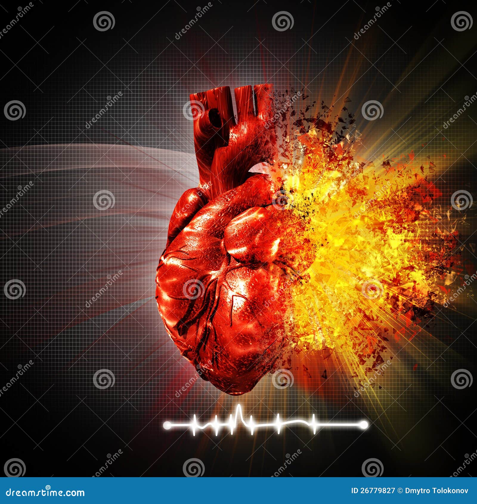 Heart attack stock illustration. Illustration of graph - 26779827